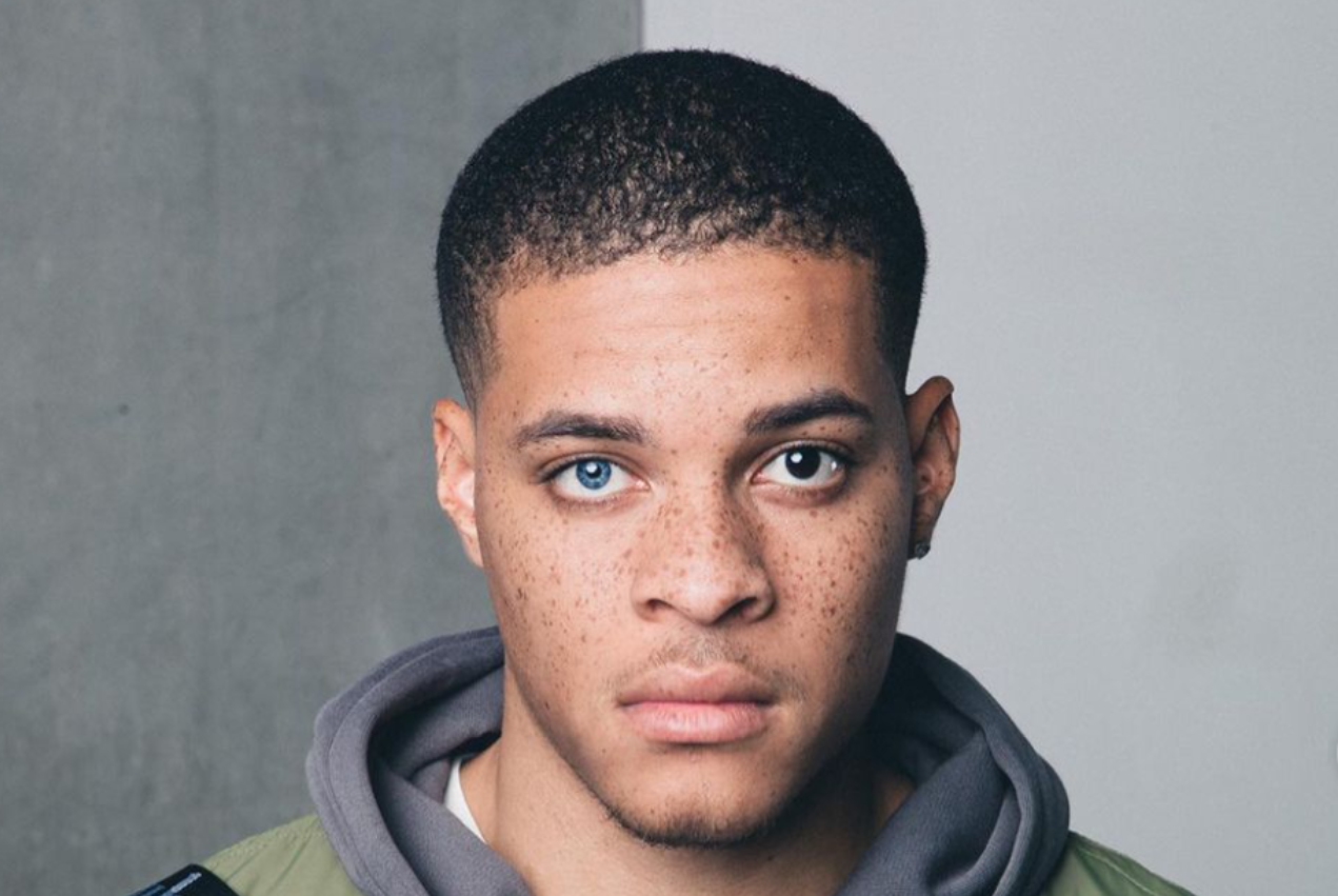 Ungewöhnliche Augen und sechs Finger: einzigartige Menschen, denen die ...