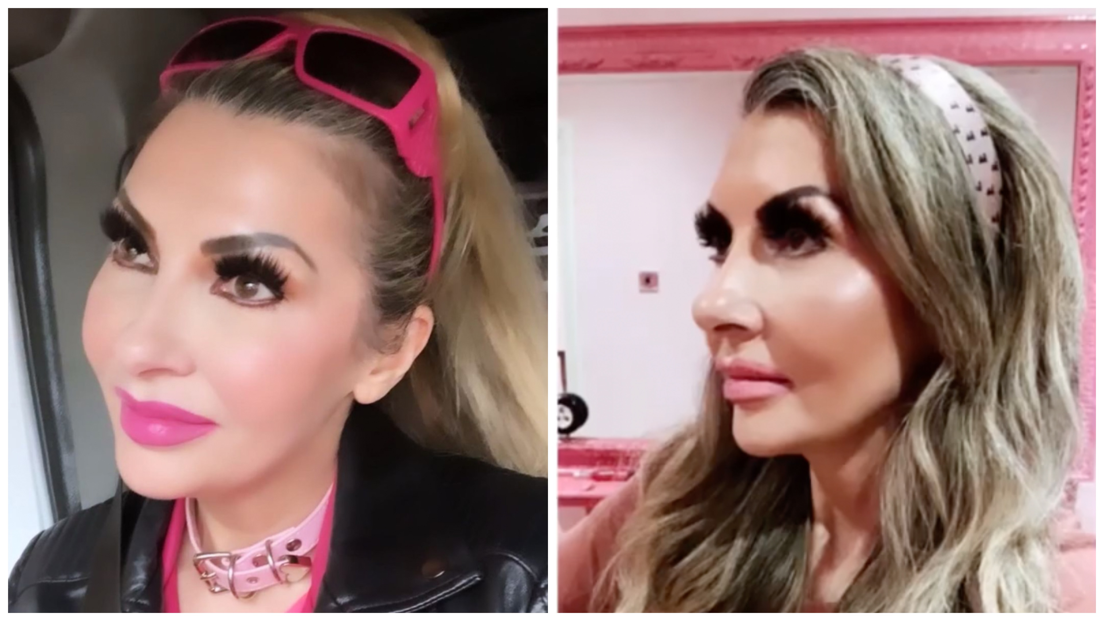 Die 48 jährige Barbie zeigte das Ergebnis ihres letzten Gesichtslifts ...