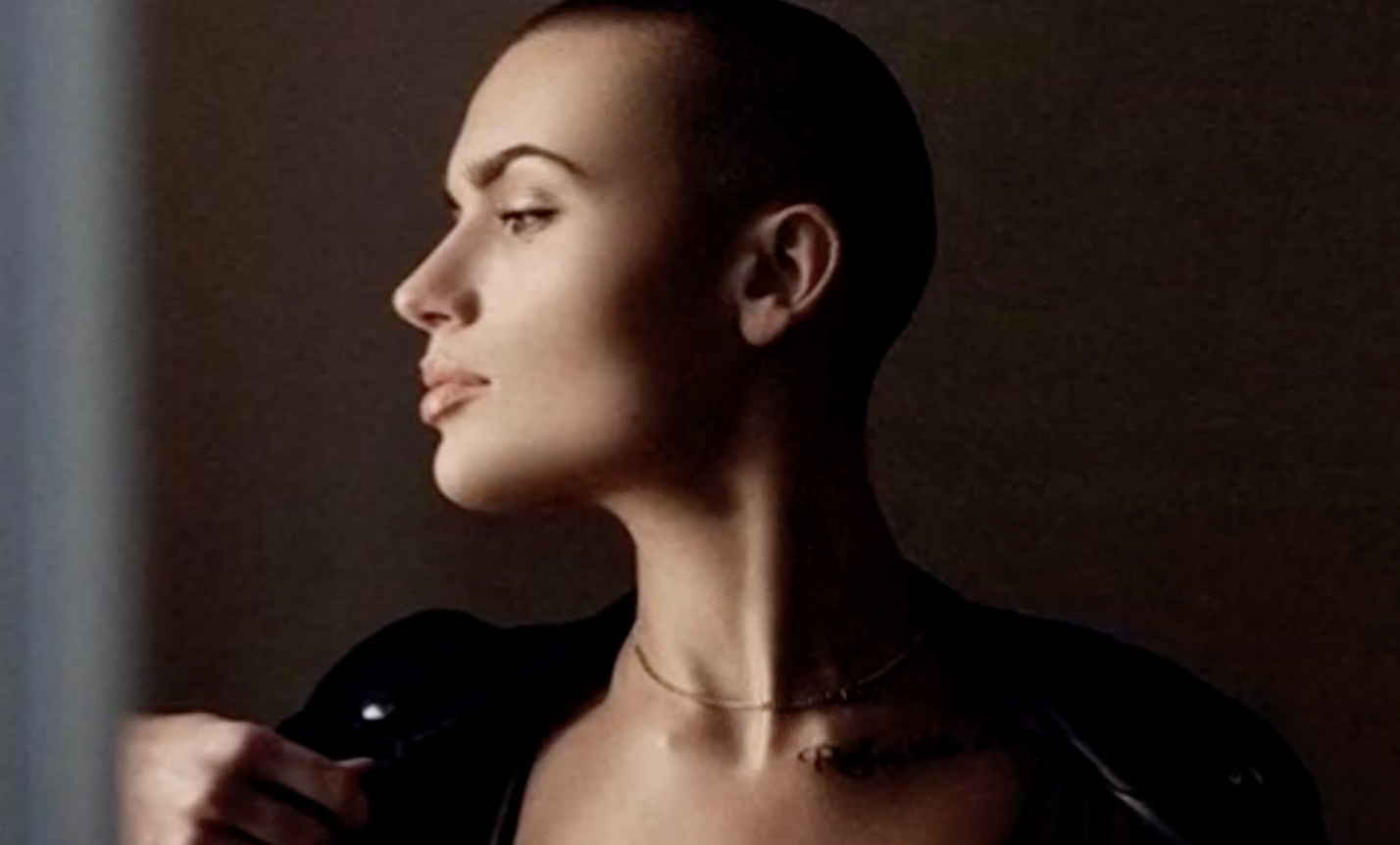 Hübsch, aber völlig haarlos: Wie das kahle Mädchen aussieht, das zur ...