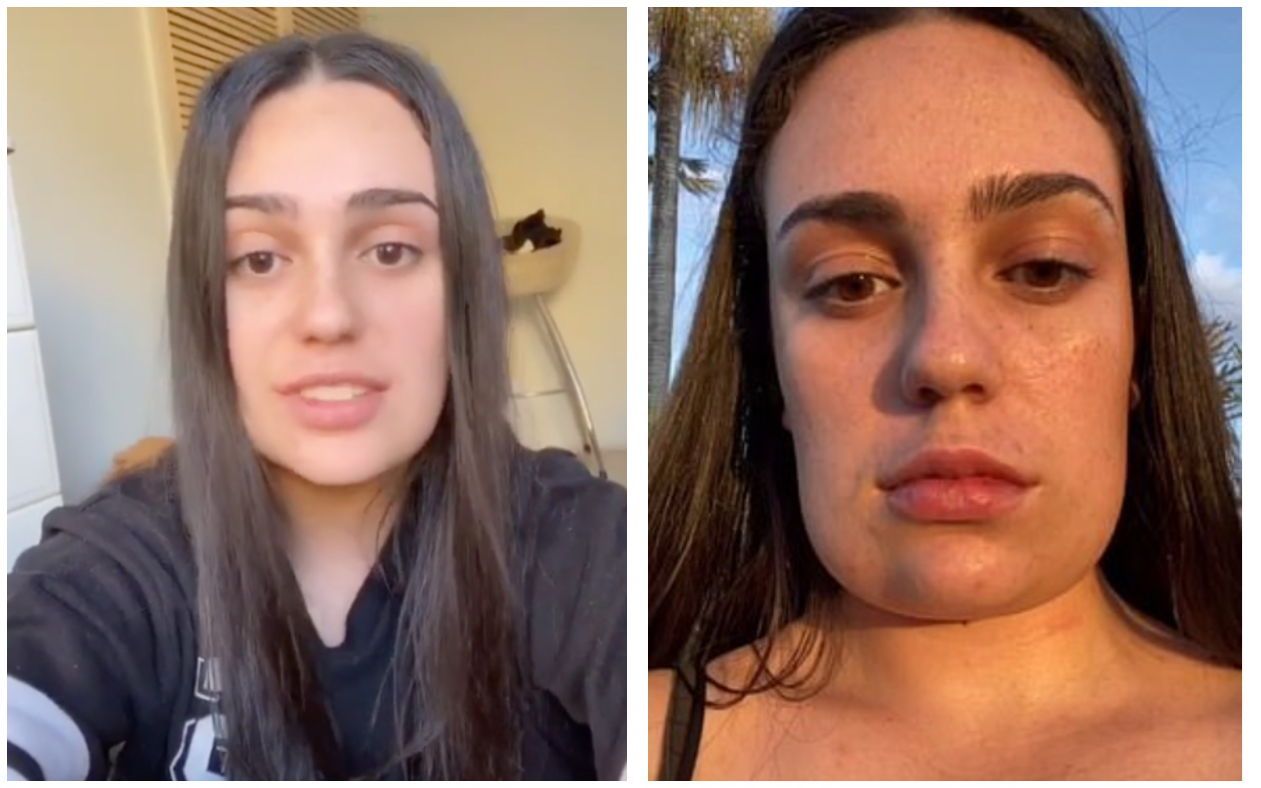 Ein Wunsch, perfekt zu sein: Eine Frau träumte von einem schönen Kinn ...