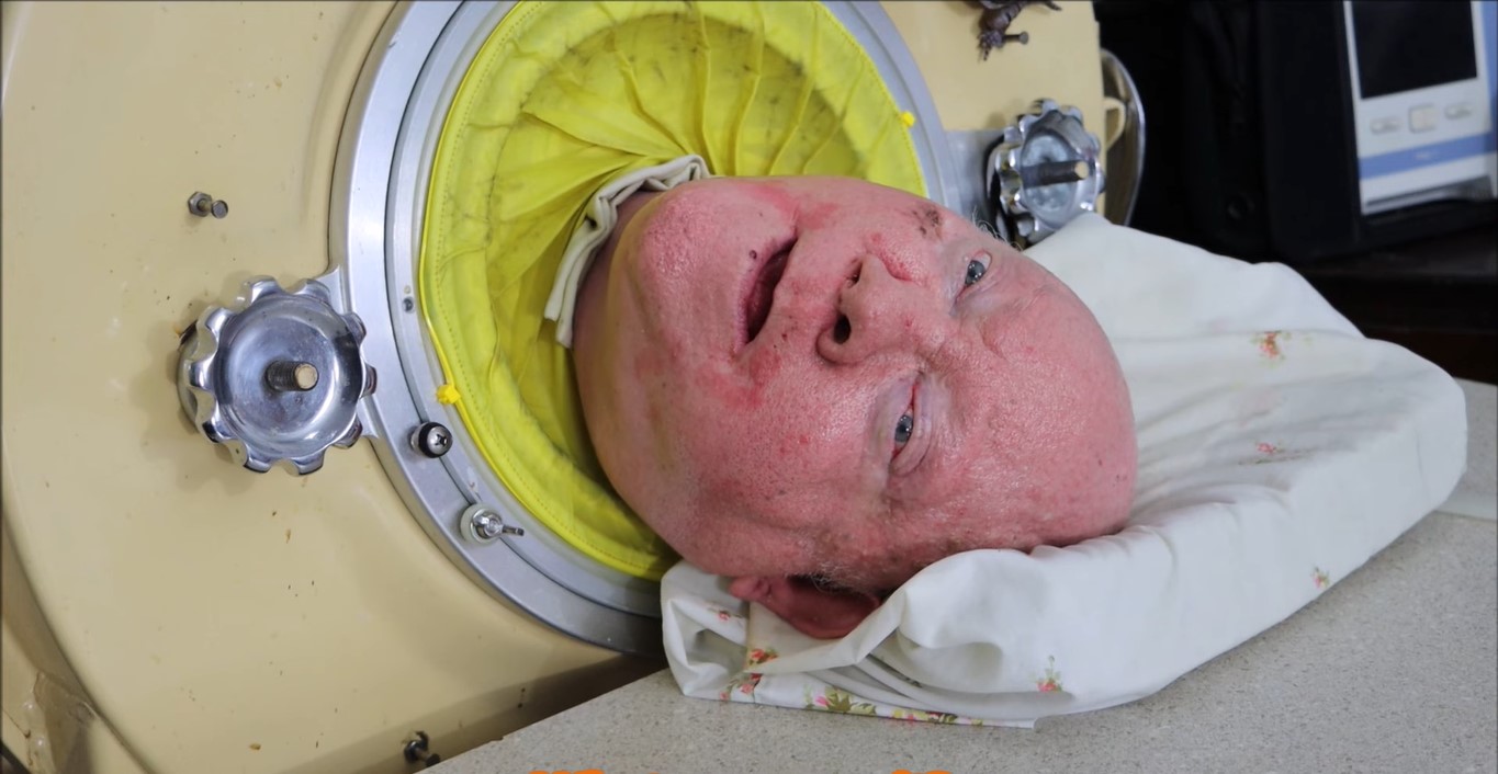 "Seit 70 Jahren begleitet ihn die eiserne Lunge: Paul Richard Alexander ...